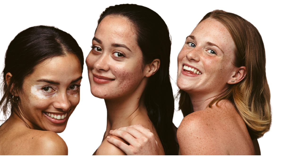 Breaking Free from Unrealistic Beauty Ideals: Embracing Your True Beau ...